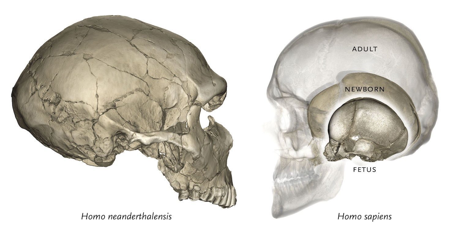 Neanderthal Genes Influence Modern Human Skull Shape Science Neanderthal Genes Influence Modern Human Skull Shape Science